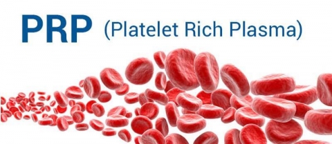 Terapi Platelet Rich Plasma (PRP) untuk Osteoarthritis (OA) Panggul