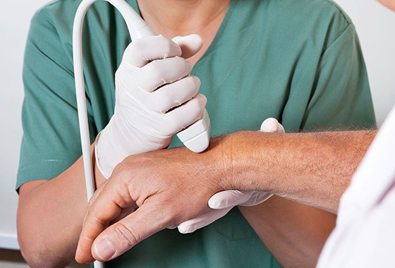 CARPAL TUNNEL SYNDROME